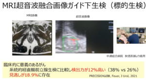 ⑤-4-2-3.S2,3PSA%検査（閾値38％）～PSAの糖鎖変化に注目：2024年に保険収載～
